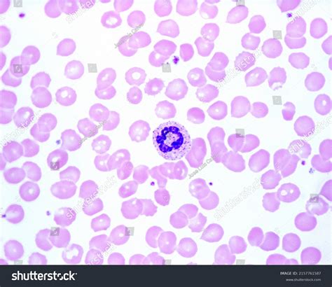 Neutrophil Granulocytes 1610 Ảnh Vector Và Hình Chụp Có Sẵn