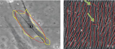 Left Manual Analysis Of Single Cell Orientation Using Imagej Right Download Scientific