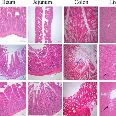 Microscopy Examination Revealed Obvious Differences In The Duodenum