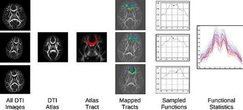 Projectsatlasbaseddtifiberanalyzerframework Namic Wiki