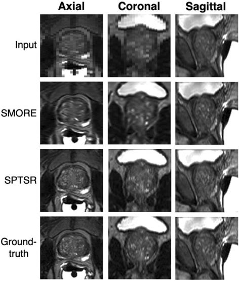 Figure 9 From High Resolution 3d Mri With Deep Generative Networks Via Novel Slice Profile