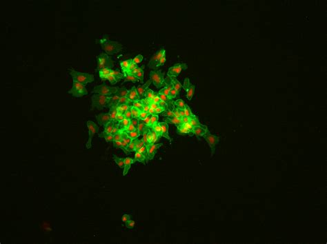 Simulation Based Inference For Physical Models Of Collective Cell Migration