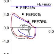 Patient S Flow Volume Loop Demonstrating Abnormalities In The