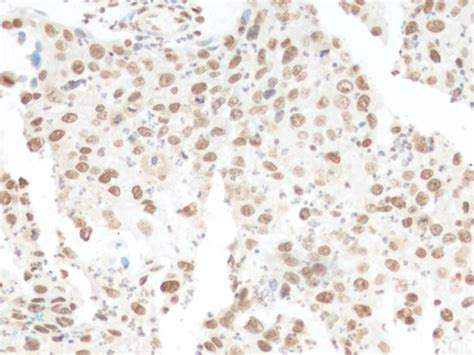 兔抗rbmx多克隆抗体anti Rbmx Rabbit Polyclonal Antibody 生命科学产品与技术服务 生工生物工程上海