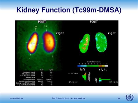 Ppt Radiation Protection In Nuclear Medicine Powerpoint Presentation