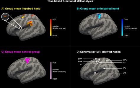 Results Of Motor Task‐based Functional Mri Analysis Mean Activation Download Scientific