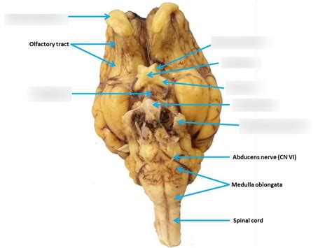 Sheep Brain Diagram Quizlet