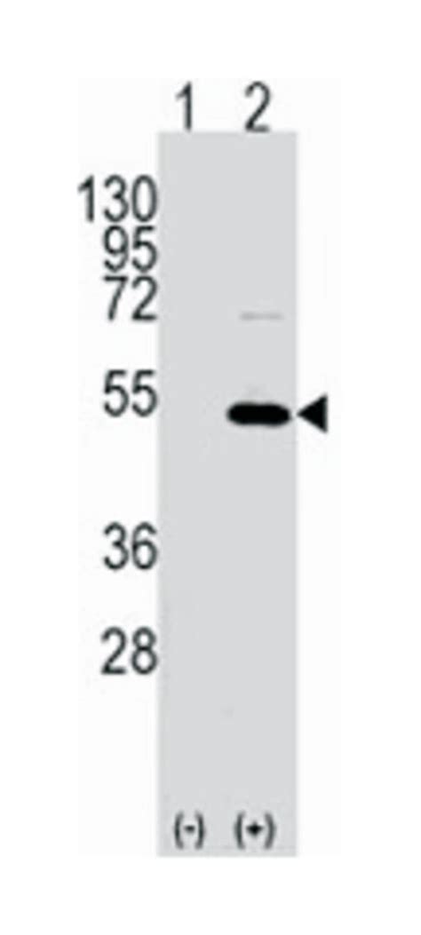 Anti Ybx1 Antibody 400ul