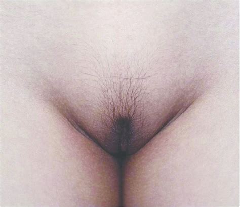 Postoperative Appearance Months After Surgery Download Scientific Diagram