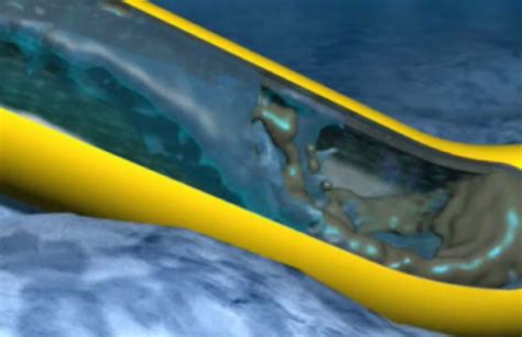 Olga Pipeline Management Slb