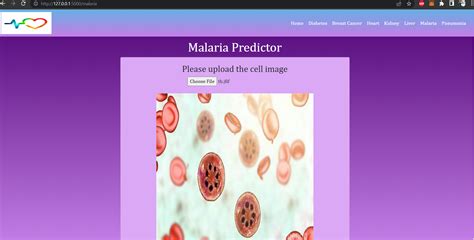 Github Kalakamcherisashanksmart Disease Predictor