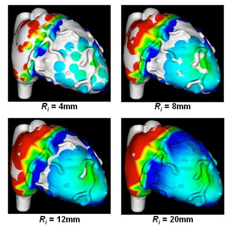 Different Cardiac Maps Based On The Radius Of Interpolation Download Scientific Diagram