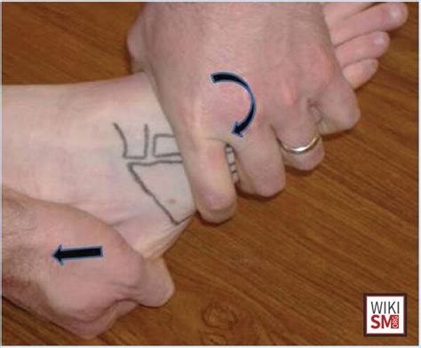 Midtarsal Supination Test Wikism Sports Medicine Wiki