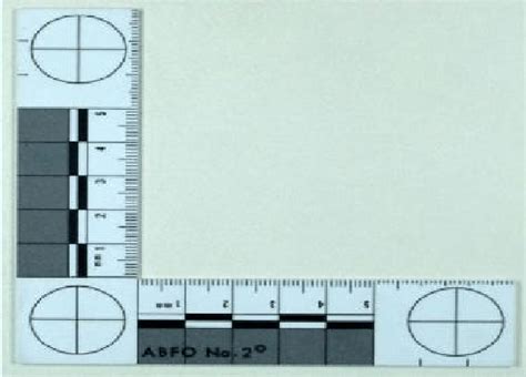 Shows An Abfo Scale That Is Commonly Used In Bite Mark Evaluation 6