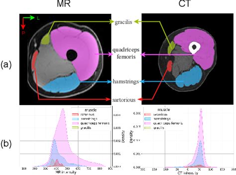Single Slice Thigh Ct Muscle Group Segmentation With Domain Adaptation And Self Training Paper