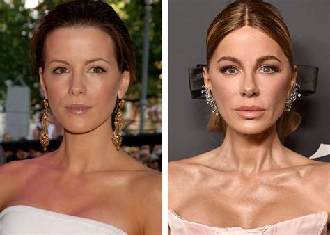 15 Celebrities Who Look Wholly Different Because Of Plastic Surgery