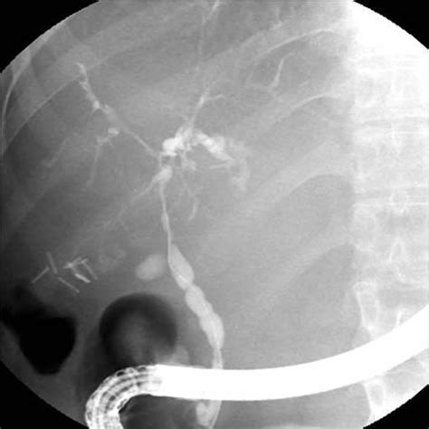 Abdomen And Retroperitoneum 1 2 Gallbladder And Bile Ducts Case 1 2