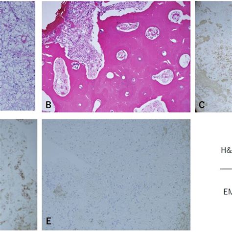 Various Types Of Physaliferous Cells Are Separated By Fibrous Septa In