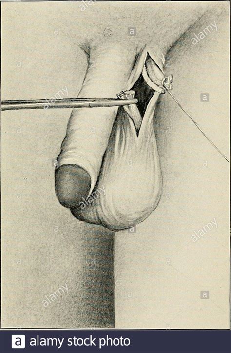 Operative Surgery For Babes And Practitioners His Ligature Should Include All The