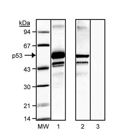 Recombinant Human P53 Protein Wildtype