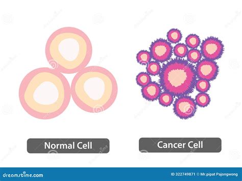 Normal Cell Vs Cancer Cell Loss Of Normal Growth Control Of Cell