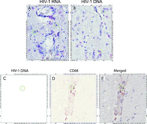 Rnadnascope In Situ Hybridization For Hiv 1 Rna And Dna Detection A Download Scientific