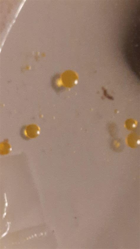 I 29f Have Been Having Orange Circles In My Stool R Askdocs