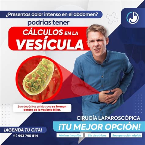 Cálculos En La Vesícula Biliar Causas Síntomas Y Tratamiento Doctor