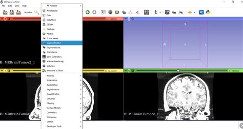 Everything Modelling And Simulation Medical Image Segmentation With D Slicer A Beginner S Guide