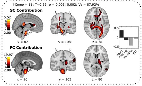 multimodal and multidomain lesion network mapping enhances prediction