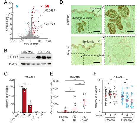 Figure 1 From Interleukins 4 And 13 Drive Lipid Abnormalities In Skin Cells Through Regulation