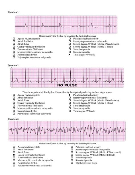The Ultimate ACLS Post Test Answer Key Get Prepared For Success