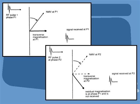 Gradient Echo Sequences And Swi Dr Harish K