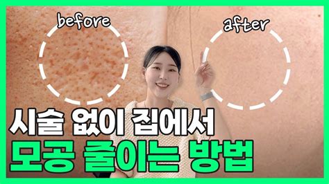 수백만원 아끼는 모공 축소 방법 깐달걀 피부로 만들어주는 홈케어 모공 관리법😊🤍 Youtube