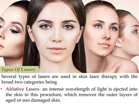 Ppt Different Types Of Laser Treatments For Skin Powerpoint