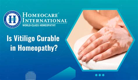 Permanent Cure For Sciatica In Homeopathy By Safehomeopathy Medium