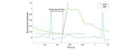 Pulse Arrival Time Calculation By The Intersecting Tangent Method