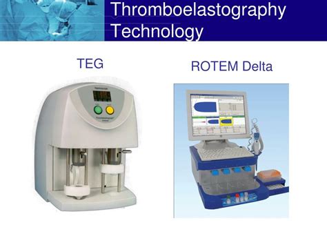 Ppt Thromboelastometry The New Coagulation Measurement Powerpoint Presentation Id2164294