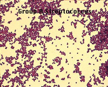 Streptococcus Pyogenes Gram Stain Reaction Slideshare