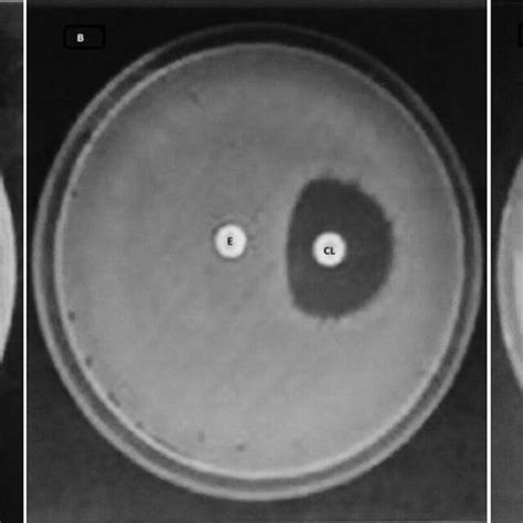 interpretation of d zone test for inducible clindamycin resistance