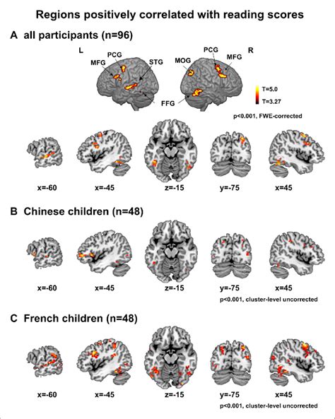 neural correlates of inter individual variability in reading scores