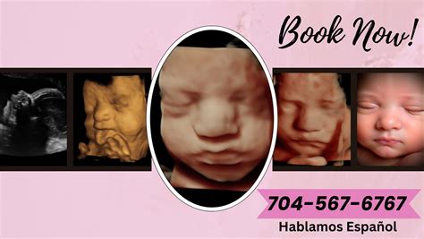 Prenatal Vision Ultrasound Prenatal Vision Ultrasound