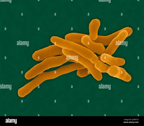 Coloured Scanning Electron Micrograph Sem Of Rhodococcus Fascians Gram Positive Filamentous