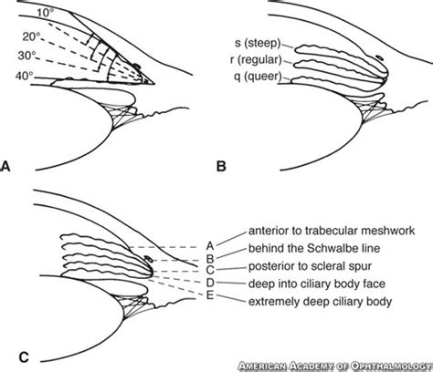 Gonioscopy Flashcards Quizlet