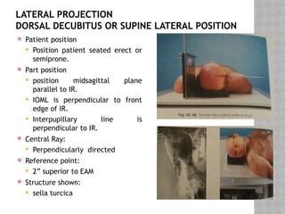 Radiographic Positioning Ii Skull Positioning Pptx