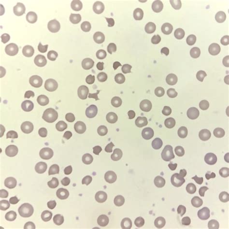 Rouleaux Medlabbuddy