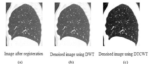 simulation results of applying dwt and dtcwt on image of lung the