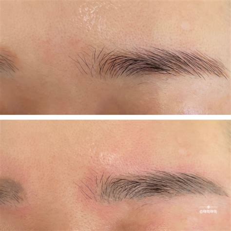 눈썹 반영구 붉은잔흔제거 데미지없는 눈썹 컬러체인지 네이버 블로그