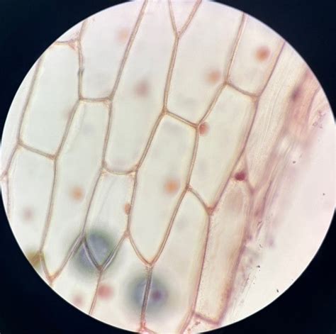 양파 표피 세포 내 액포 관찰 되는건가요 이 사진에서 지식in