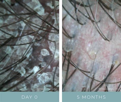 Neogenesis Recovery Serum Advanced Cellular Serum